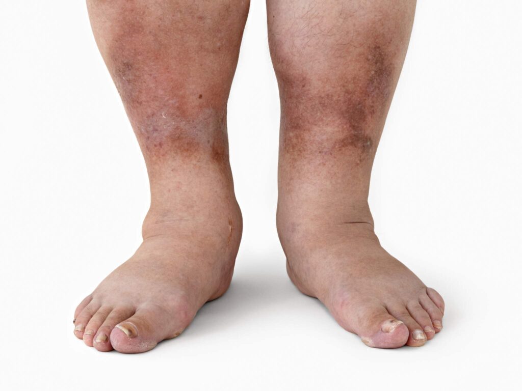 A Diabetic Foot Care Guide // Texas Foot and Ankle Center